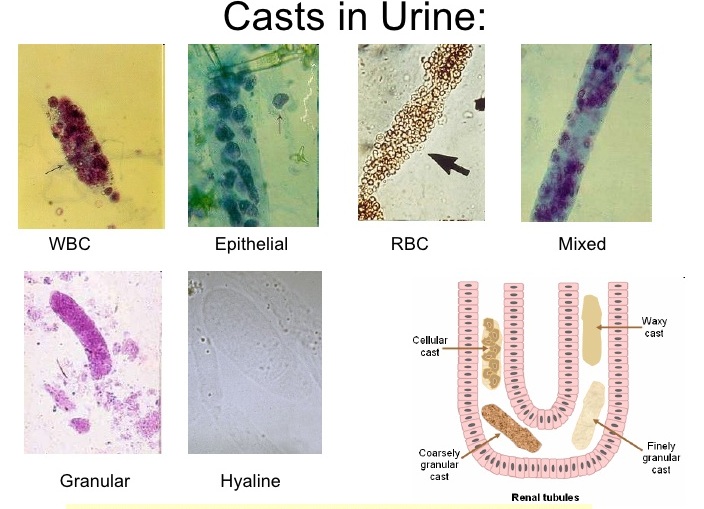 Шээсний дэлгэрэнгүй шинжилгээ /II хэсэг/ | Medwebmon